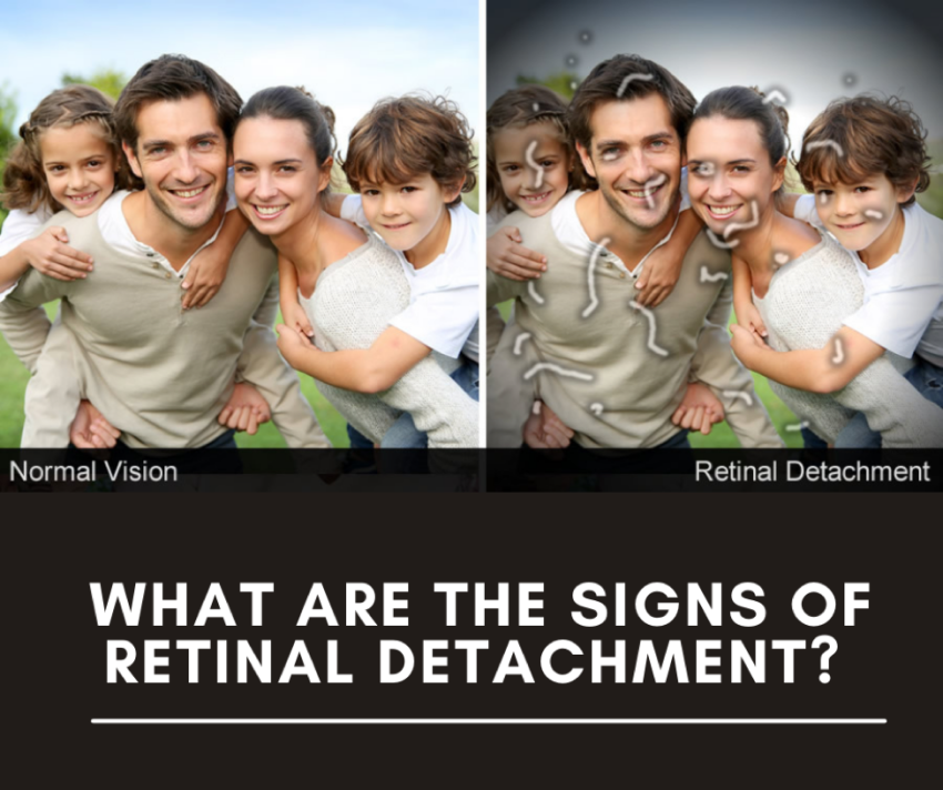 What Are The Signs Of Retinal Detachment? | Georgia Eye Associates